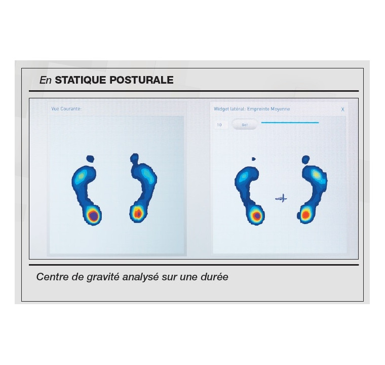 PRESSMAT™: Plantar pressure platform – www.e-podiatech.com