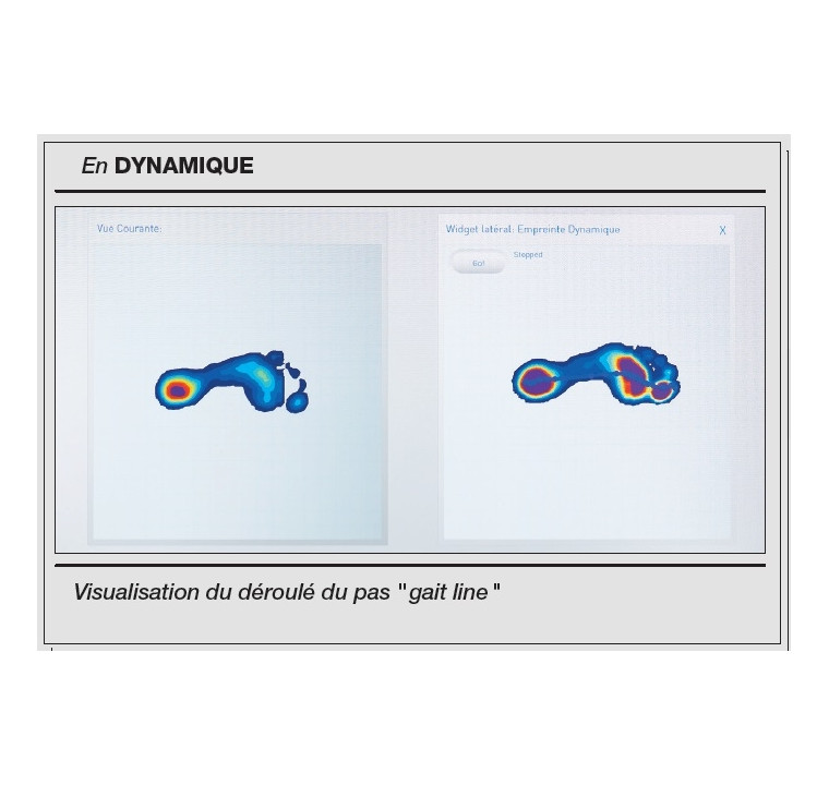 PRESSMAT™: Plantar pressure platform – www.e-podiatech.com